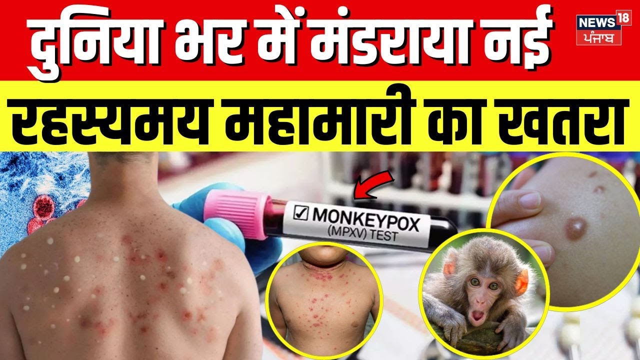 Rajasthan News : दुनिया भर में मंडराया नई रहस्यमय महामारी का खतरा ...