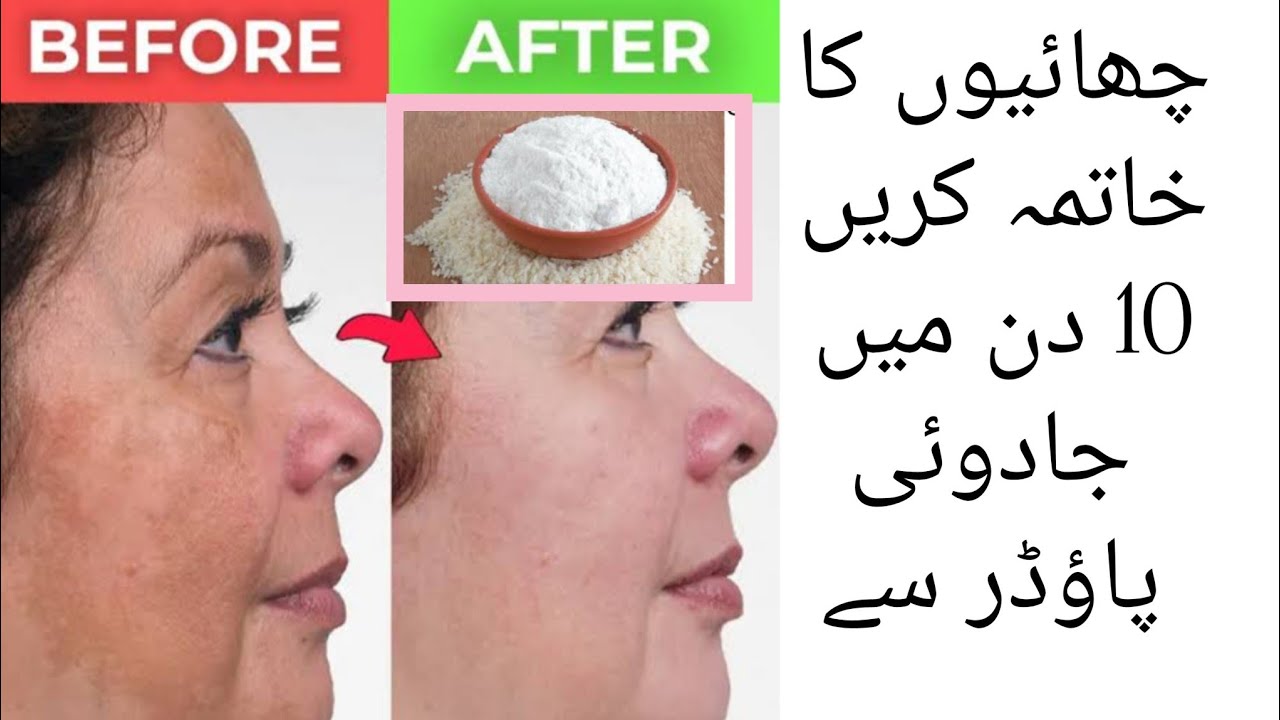 Best skin routine for remove pigmentation | Home made night cream for ...