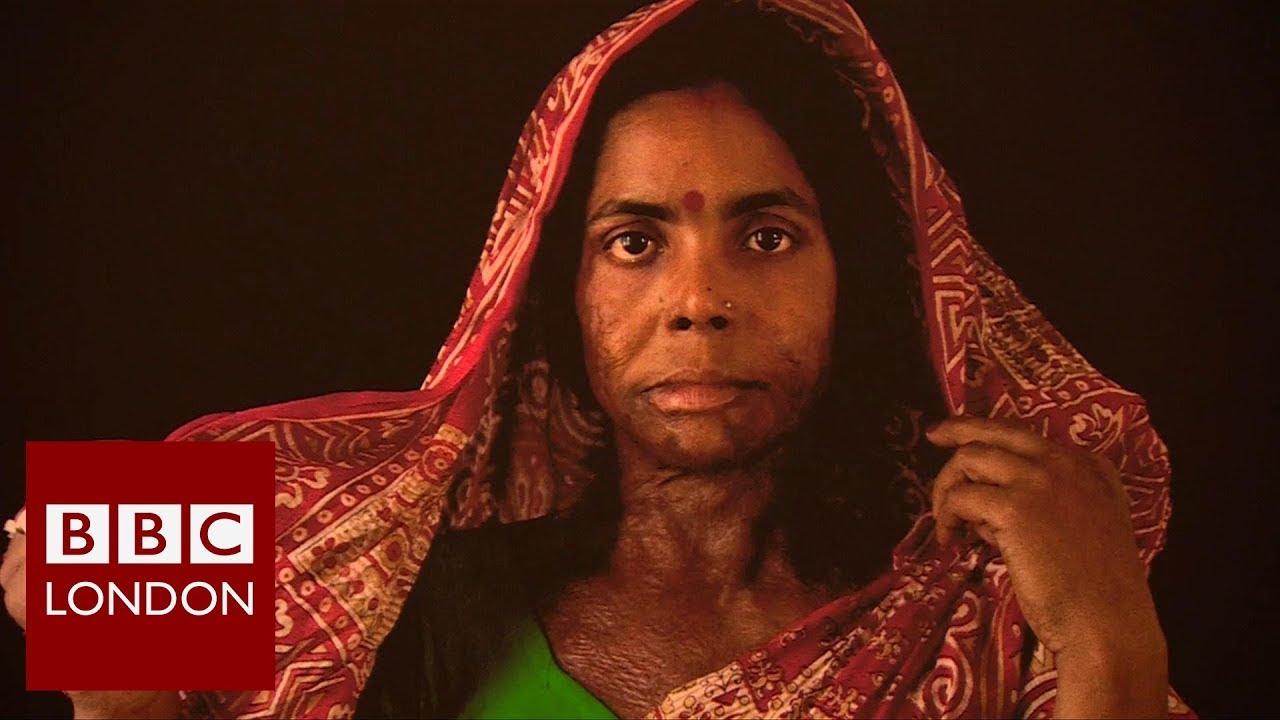 A photo exhibition of acid attack survivors – BBC London News - YouTube