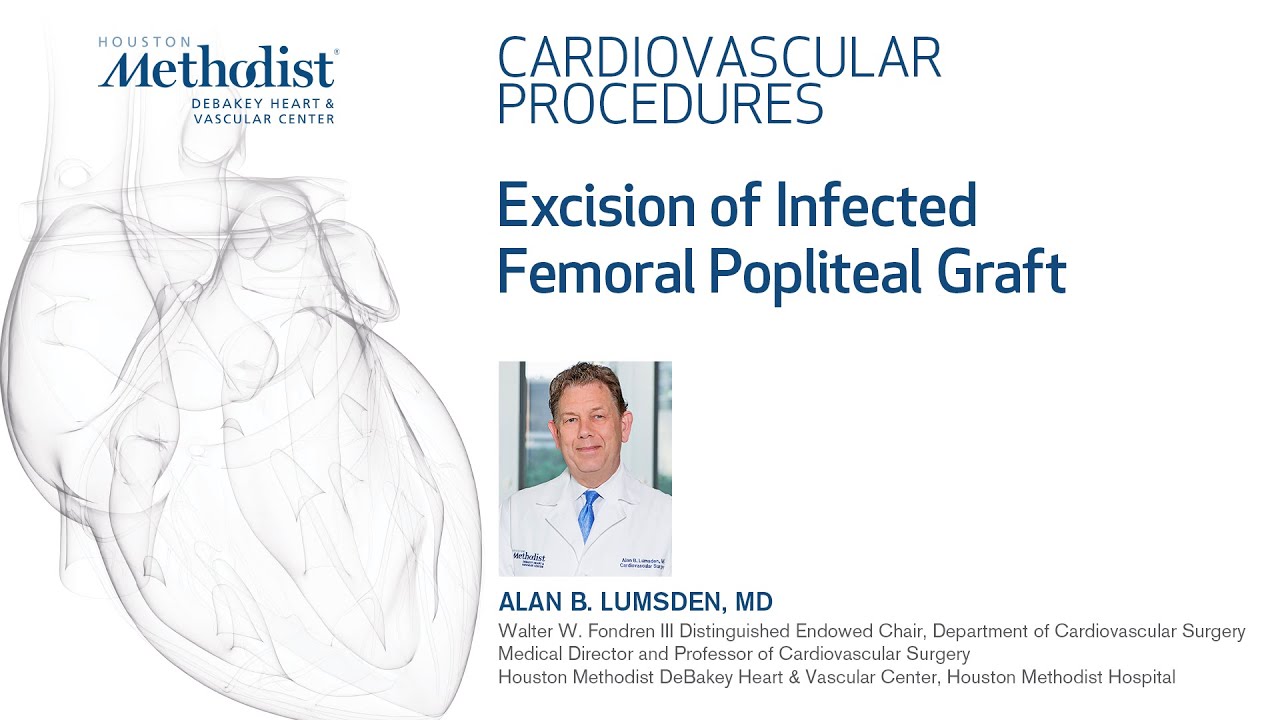 Excision of Infected Femoral Popliteal Graft (Alan Lumsden, MD) - YouTube