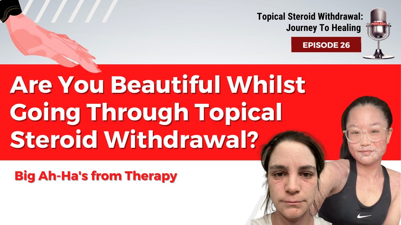 What is Beauty? Can You Feel Beautiful with TSW (Topical Steroid ...