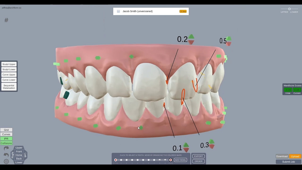 ArchForm Tutorial - How Staging is Calculated and How to Adjust it - YouTube