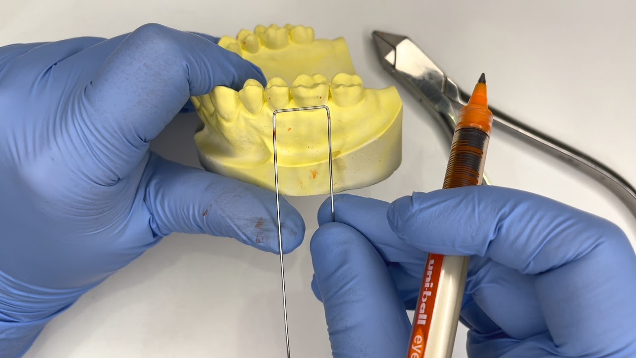 Double Adam's Clasp prepared by Dr. Maryam - YouTube