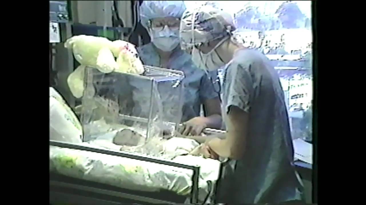 Stephanie's Heart: The Story of Baby Fae - Part 2 - YouTube