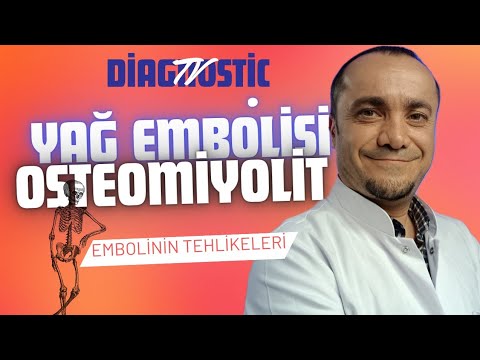 YAĞ EMBOLİSİ VE OSTEOMİYELİT | Emboli Tehlikeli midir?