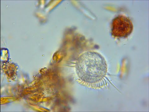 Strobilidium - YouTube