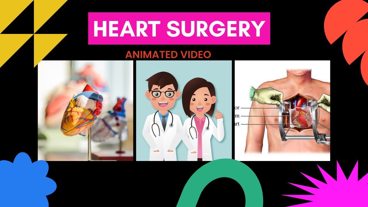 Animated Heart surgery||aorta||artery||medical cardiac open heart ...