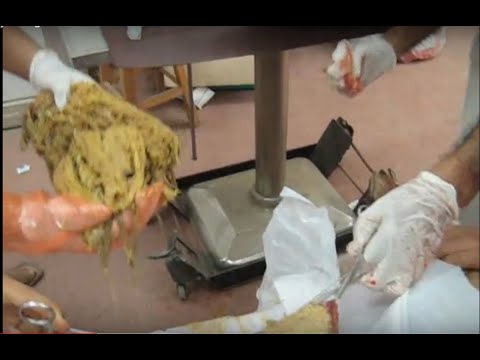 Rumenotomy of goat🐐 Rumenotomia de cabras 🐐 Rumenotomía cabras 🐐 ...