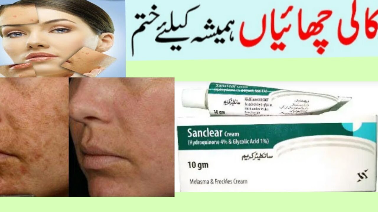 Sanclear Cream - YouTube