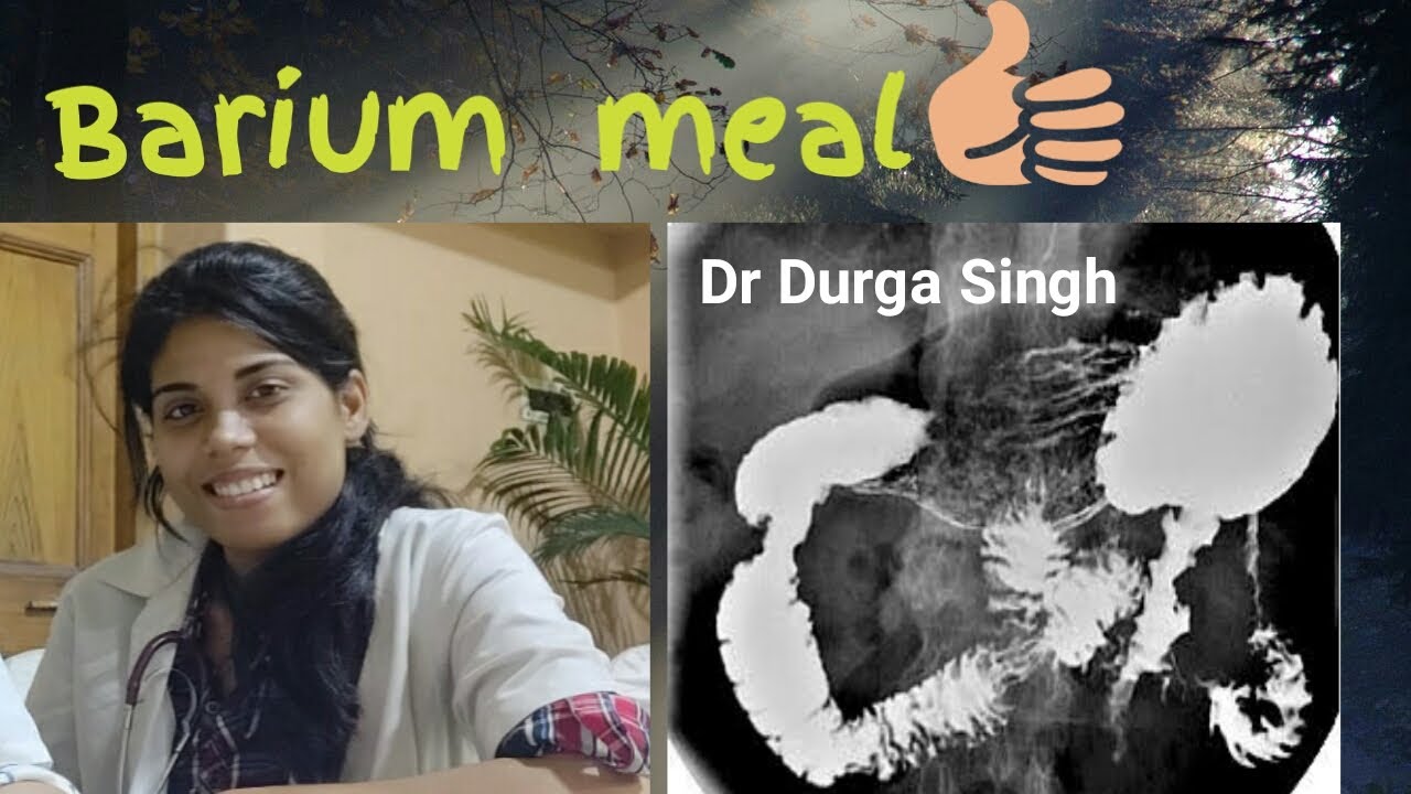 Barium meal - Part 3 in Barium series - YouTube