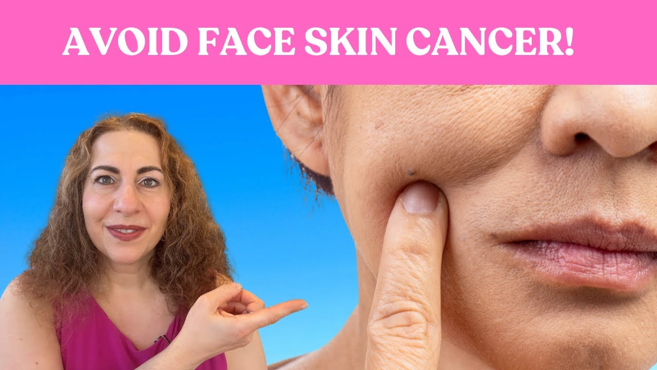 Protect Your FACE from Skin Cancer! - YouTube