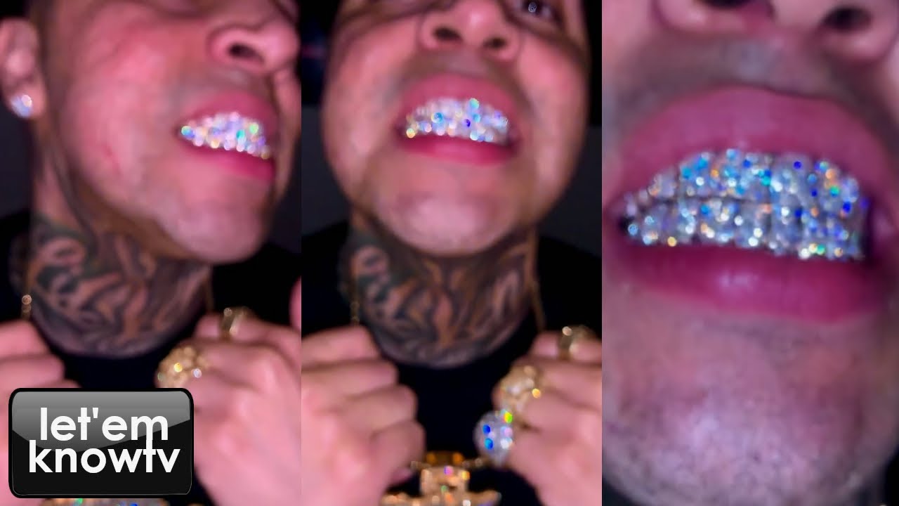 YTM Lilvent Just Got Himself This Crazy Diamond Grill From The Jeweler ...