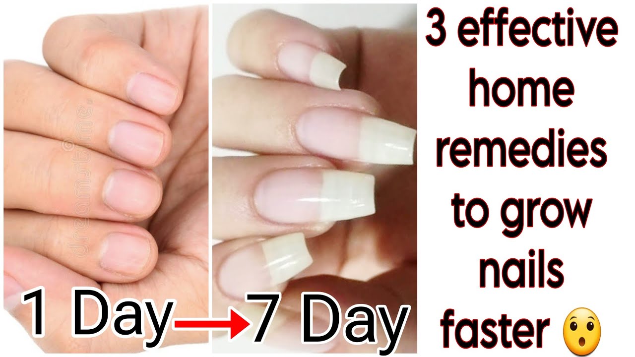 Grow nails in just 2 days || faster nail growth tips ||How to grow ...