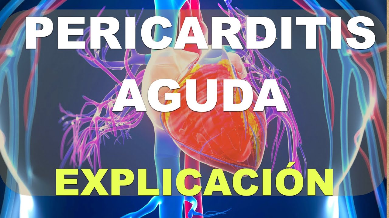 Pericarditis Aguda: Qué es, síntomas, tratamiento - YouTube