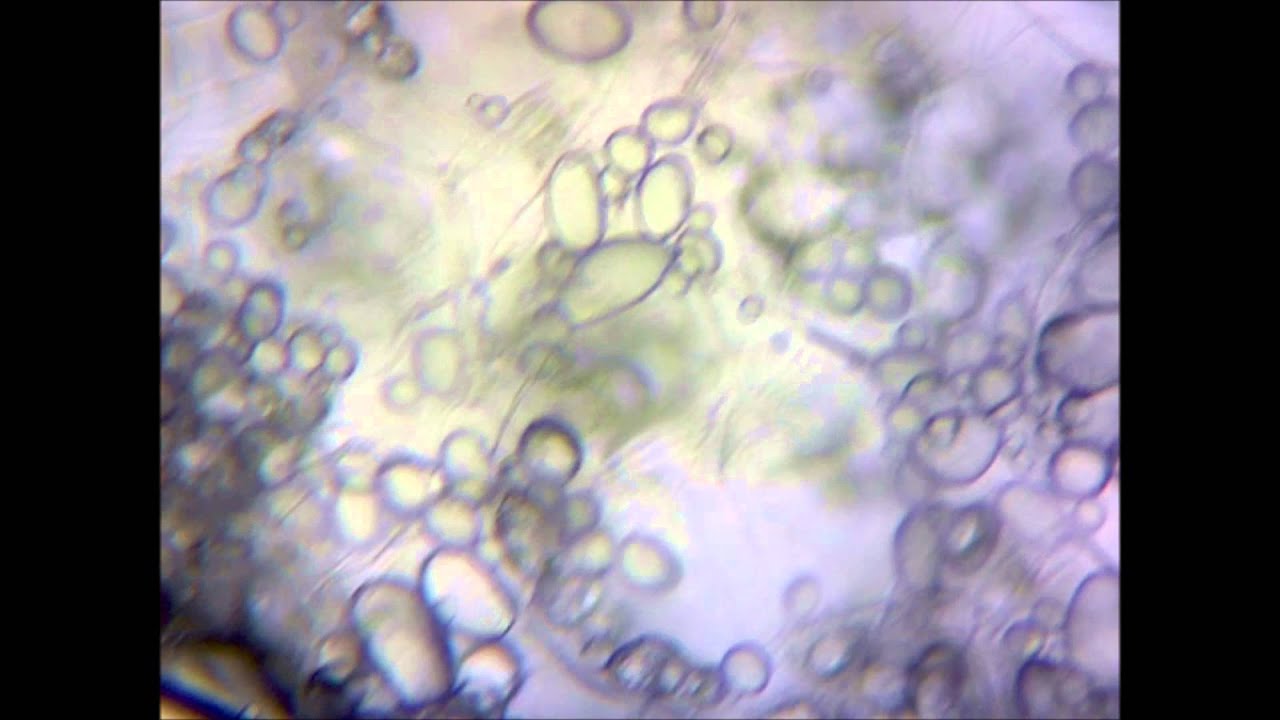 Starch and Leucoplast ( Solanum tuberosum ) - YouTube