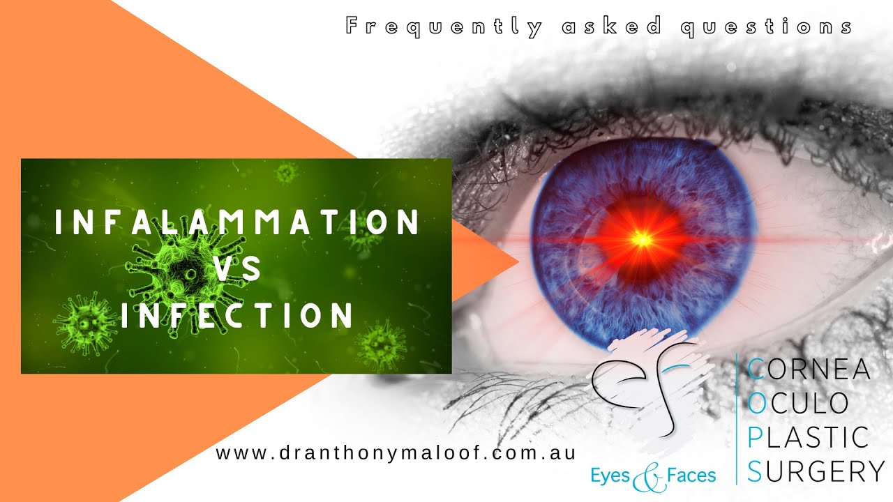 FAQ Inflammation vs Infection Dr Anthony Maloof Sydney - YouTube
