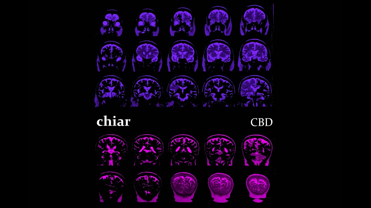 CHIAR - CBD (2023) - YouTube