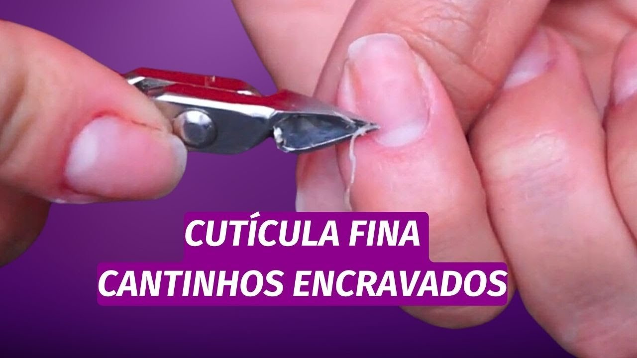 TÉCNICAS PARA RETIRAR CUTÍCULAS FINAS E CANTINHOS ENCRAVADOS | MANICURE ...