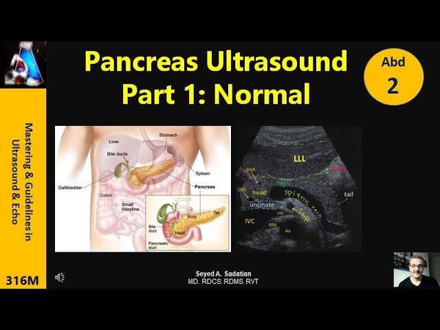 Pancreas Anatomy Ultrasound Ultrasonography Of The Pancreas