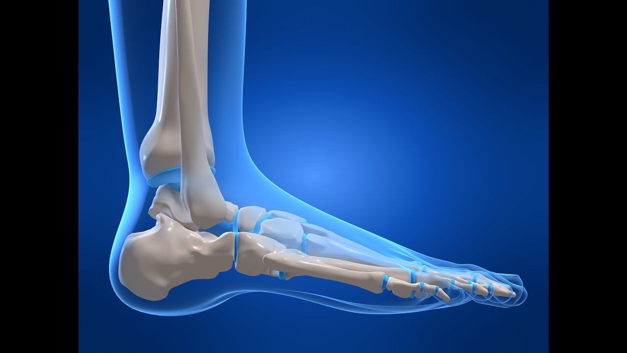 Global Orthotics Custom Made Orthotics - YouTube