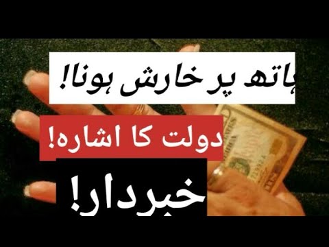 Hath par kharish hona kaise hai //hand foot kharish hona kaise ki - YouTube