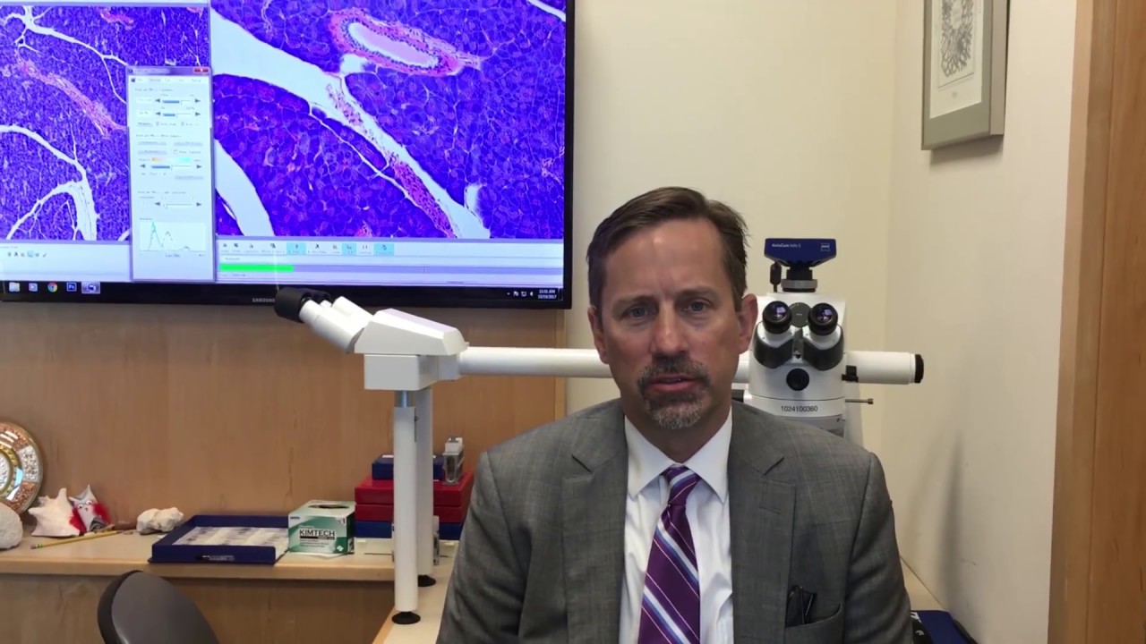 Dr. David Tuveson on World Pancreatic Cancer Day - YouTube
