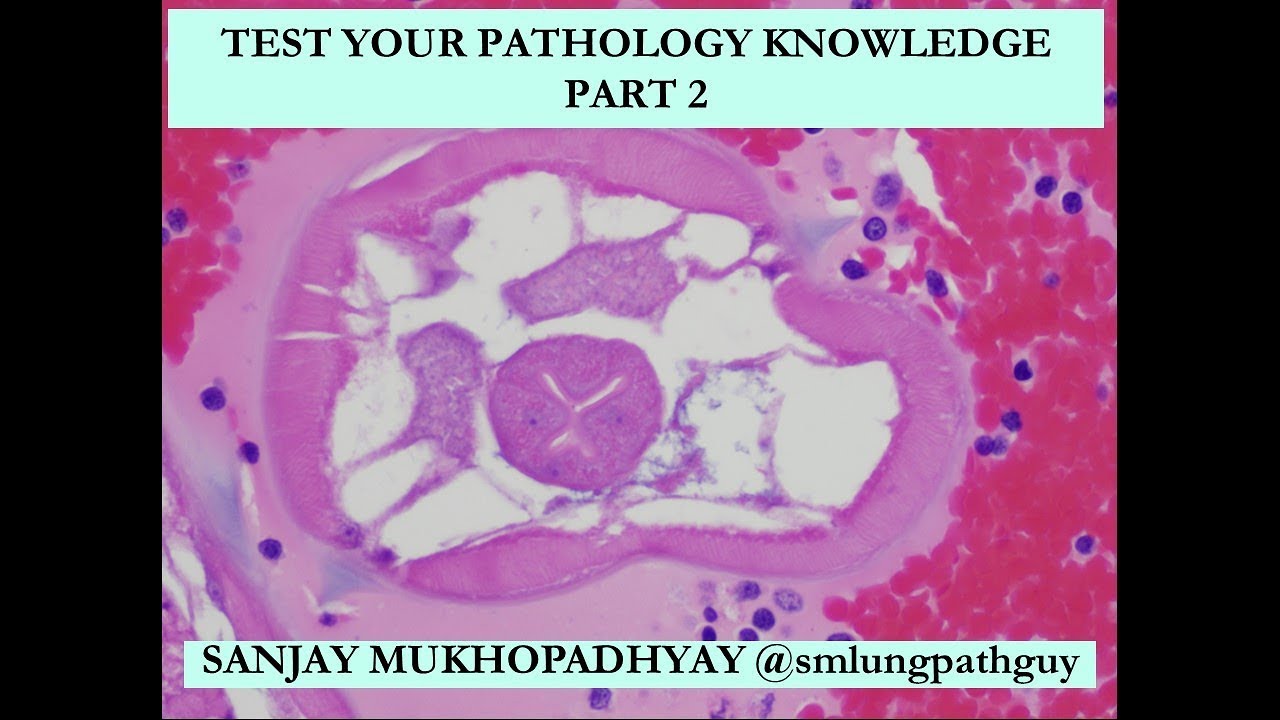 Test Your Pathology Knowledge, Part 2 - YouTube