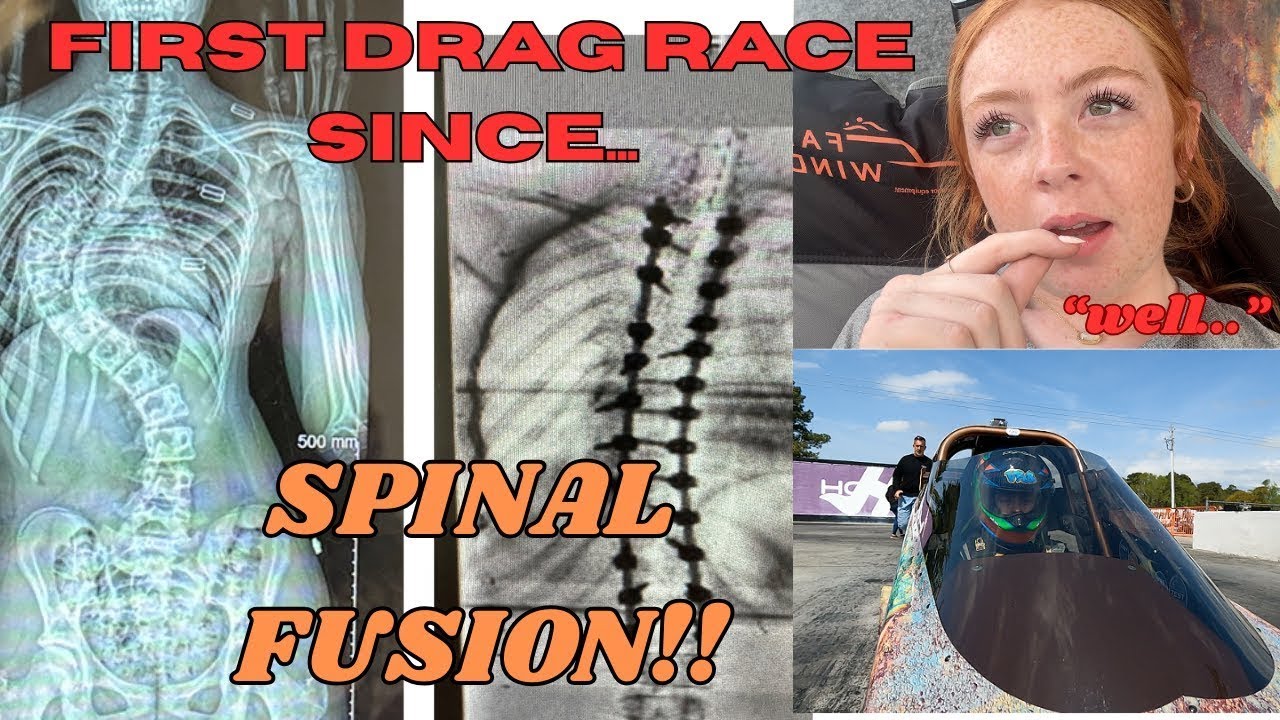 first drag race since spinal fusion!! what happened?? - YouTube