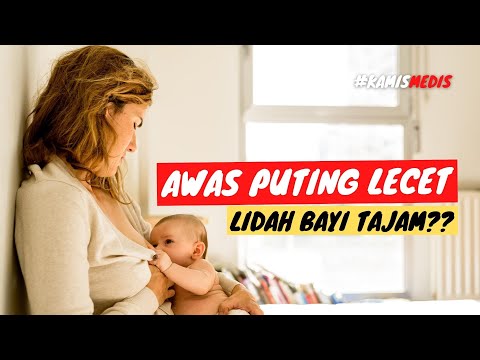 Awas Puting Lecet ❗❗ Lidah Bayi Tajam❓❓