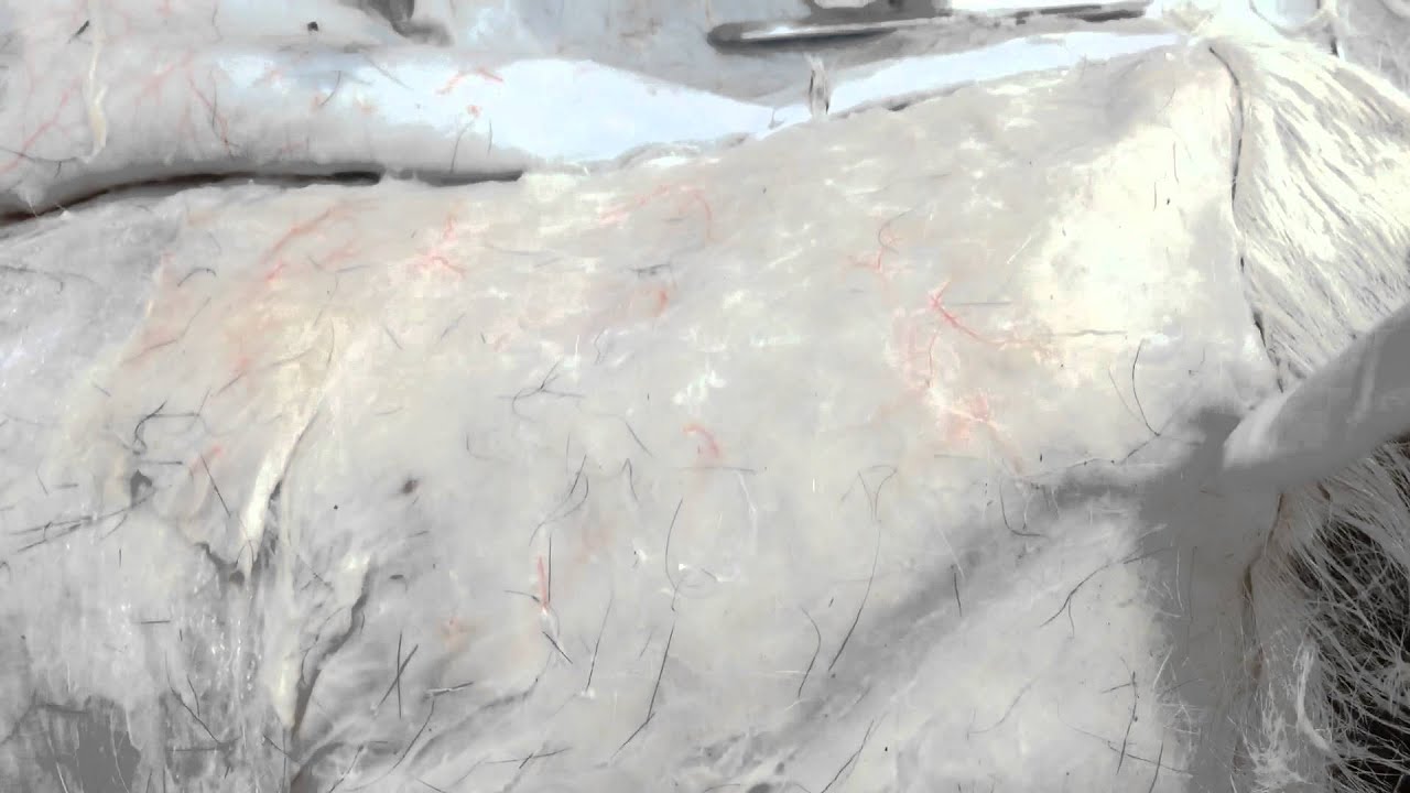 cutaneous trunci + cutaneous omobrachialis - YouTube