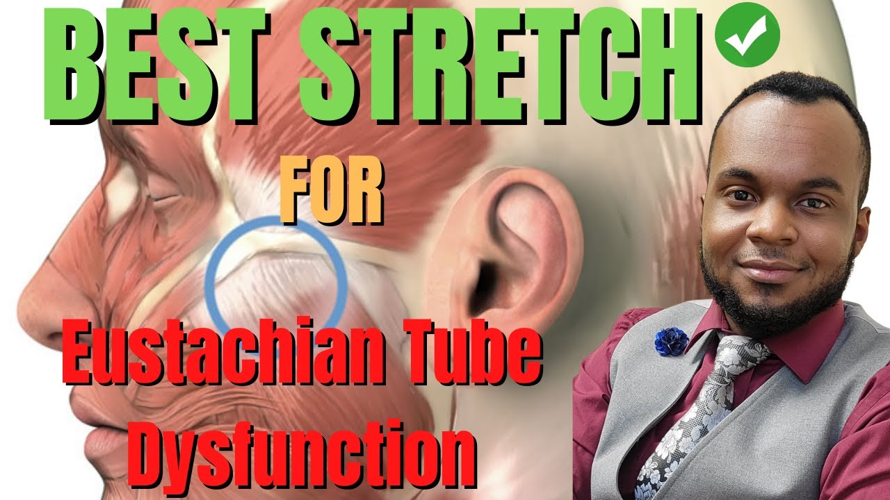 Best Stretch Eustachian Tube Dysfunction - This Will Change Your Life ...