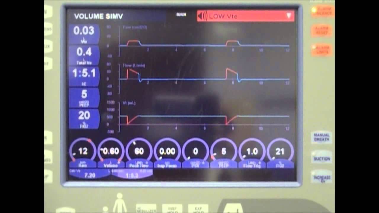 Viasys Avea Ventilator with Blom Tracheostomy Tube - YouTube