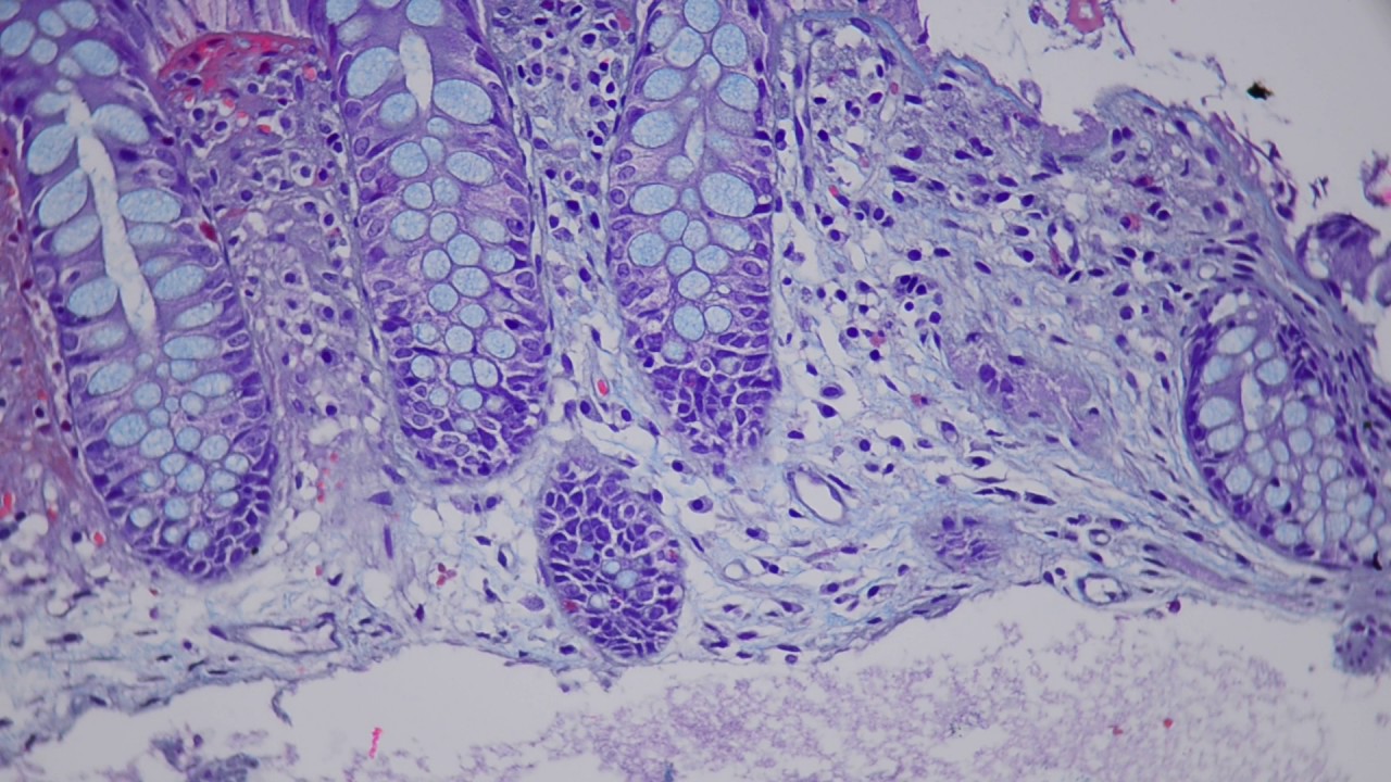 021 Normal Ileum and colon mucosa, HEA50 stain - YouTube