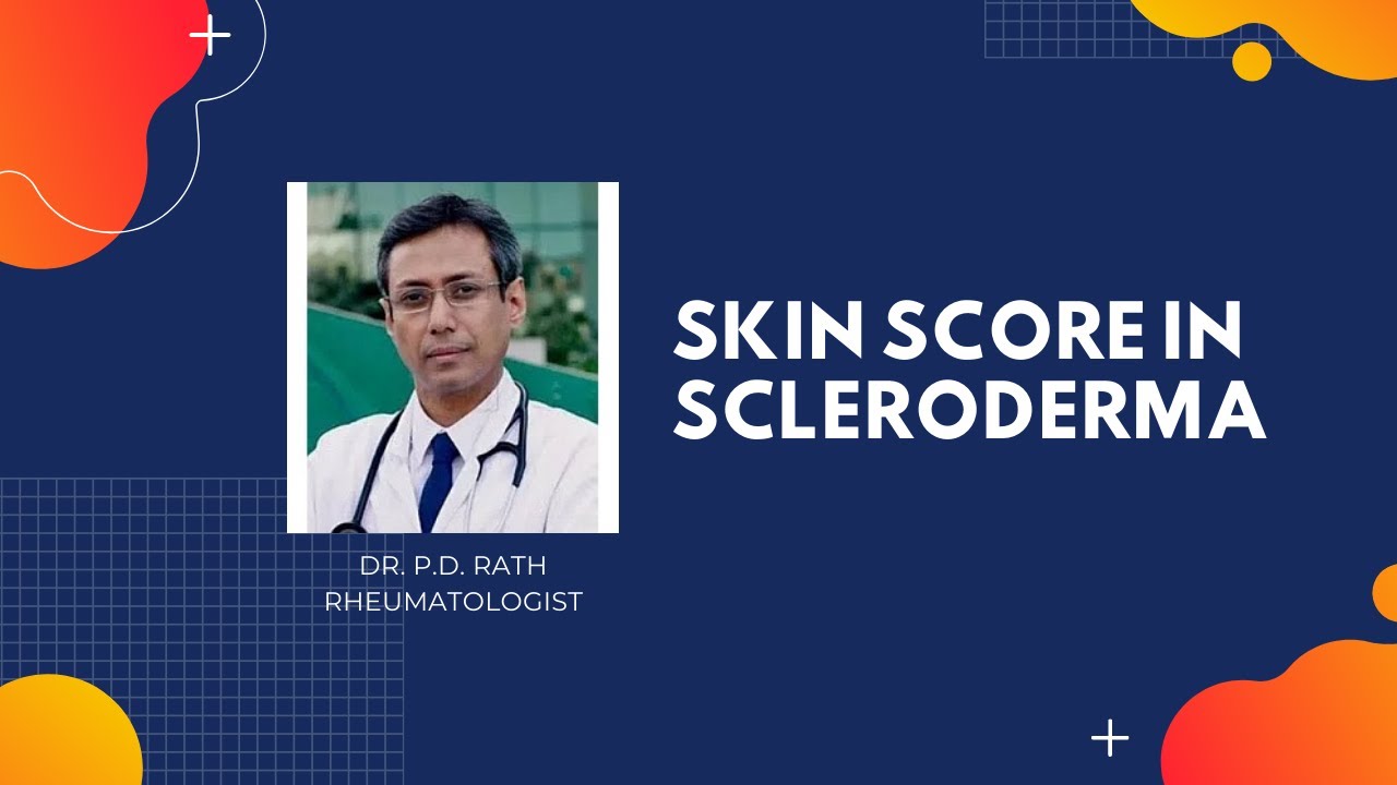 Skin Score in Scleroderma - YouTube