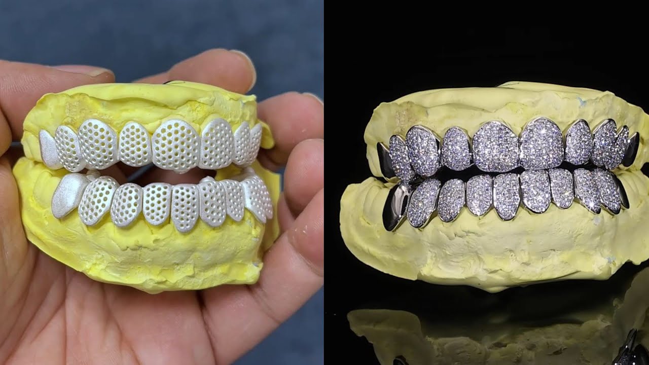 We bring the best Grillz to this game with the most professional ...