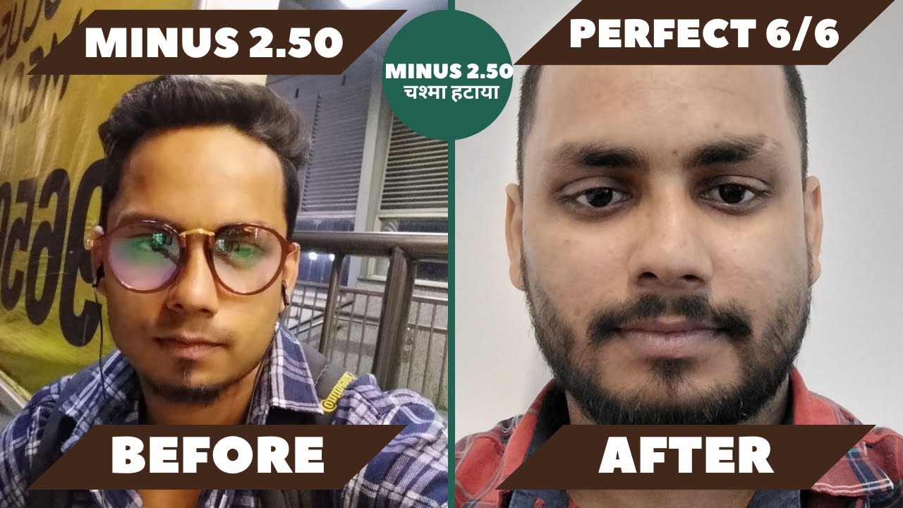 How i Make my Assistant free from Glasses Minus 2 50 Power to 6 6 ...