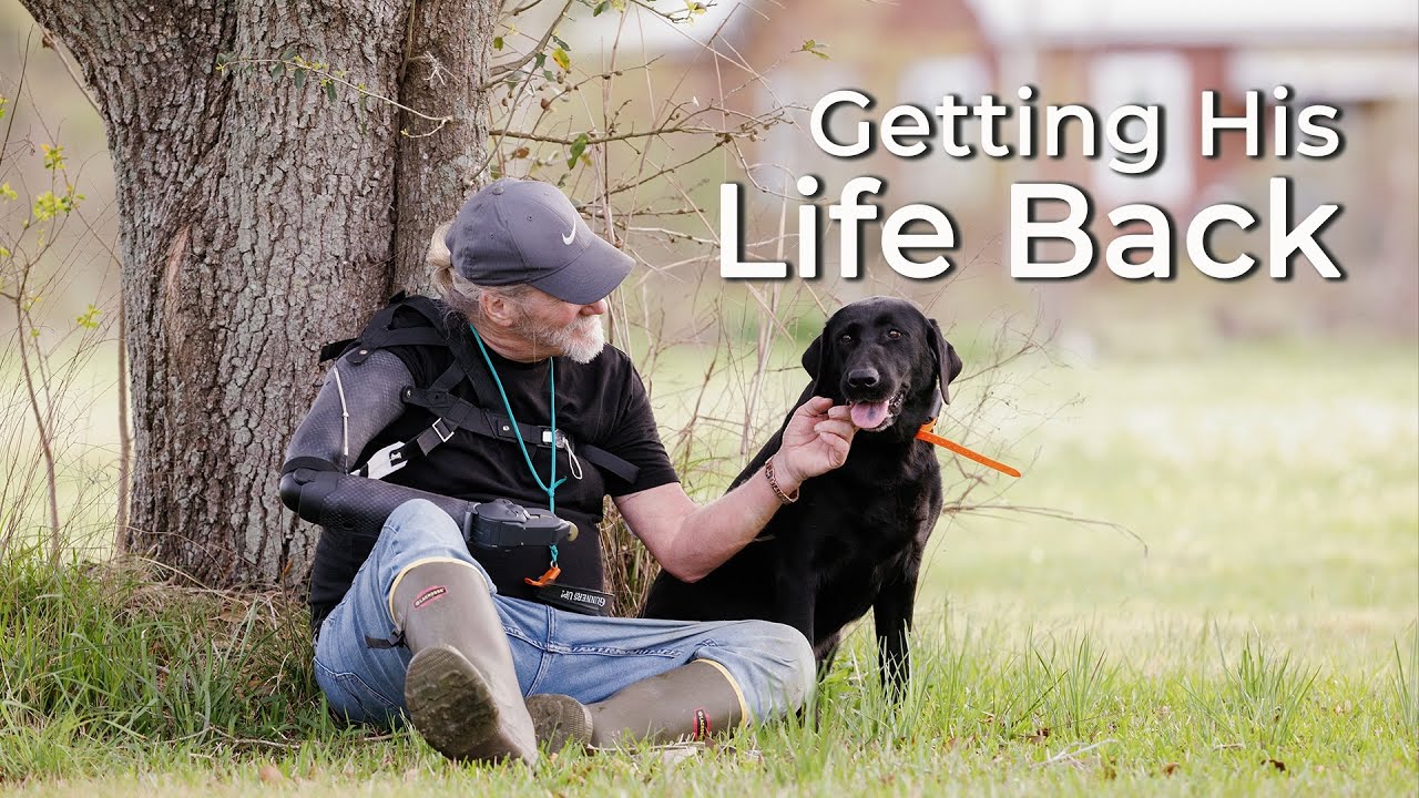 How a Life-Saving Procedure and a Prosthetic Arm Gave Jim His Life Back ...