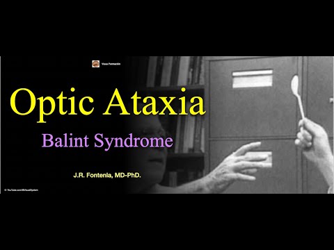 Optic Ataxia. - YouTube