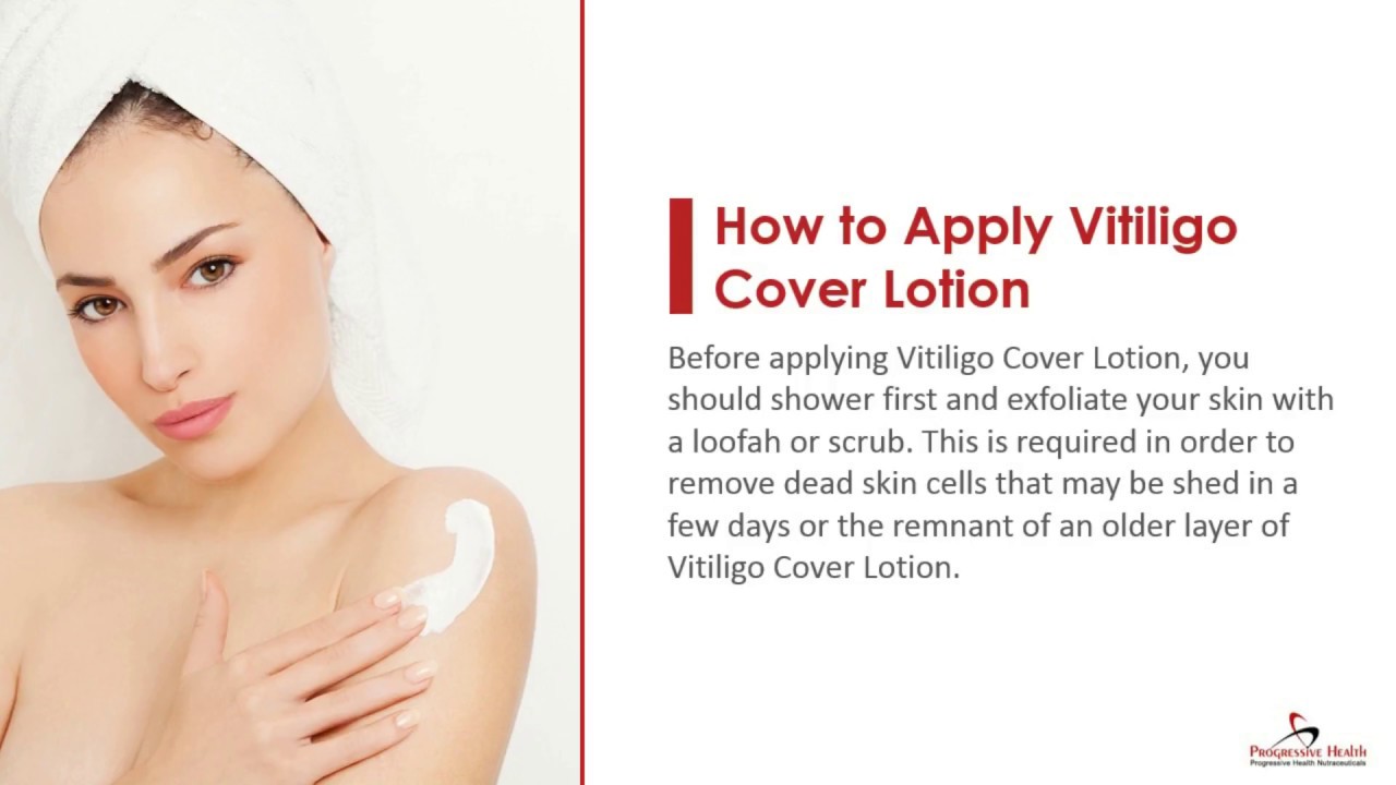 Vitiligo Cover Lotion - YouTube