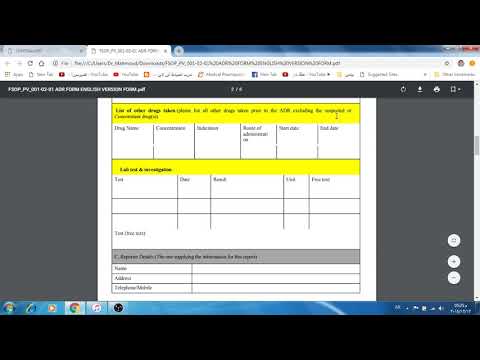 PHARMACOVIGILANCE LEC 20 ICSR : COMPLETE ICSR FORM EXAMPLE - YouTube