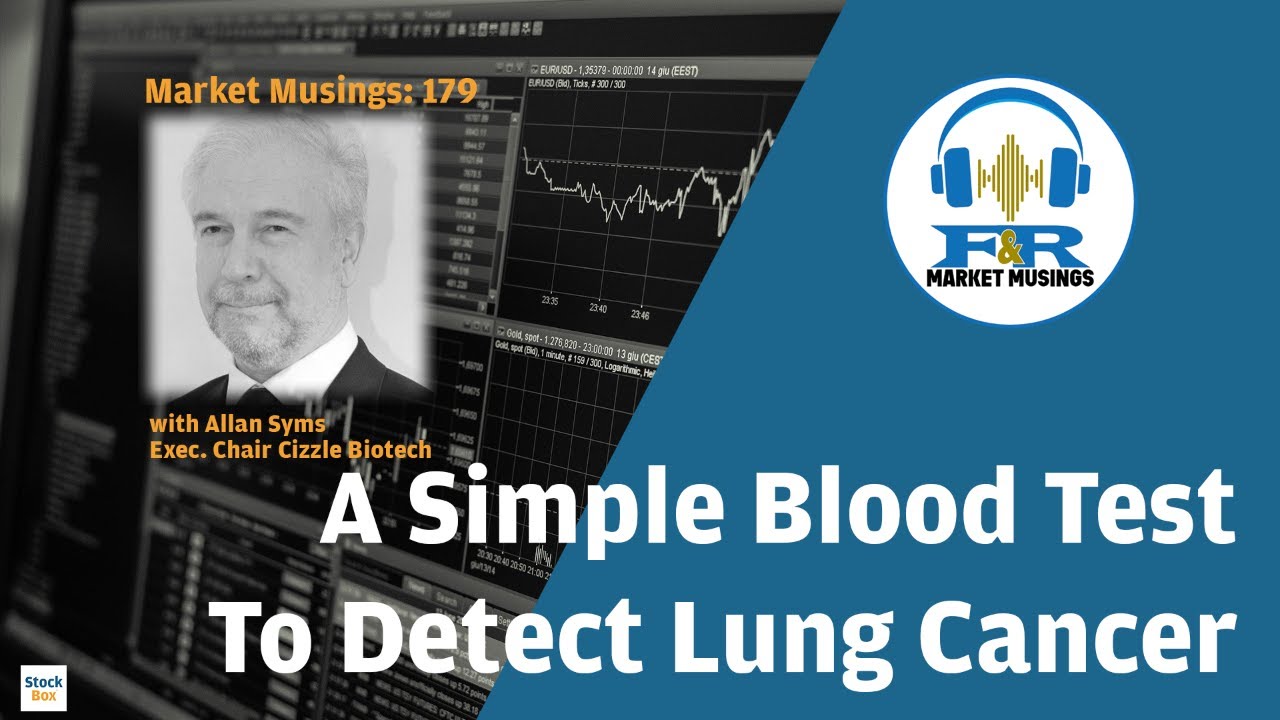 A Simple Blood Test To Detect Lung Cancer w/ Allan Syms Chairman Cizzle ...