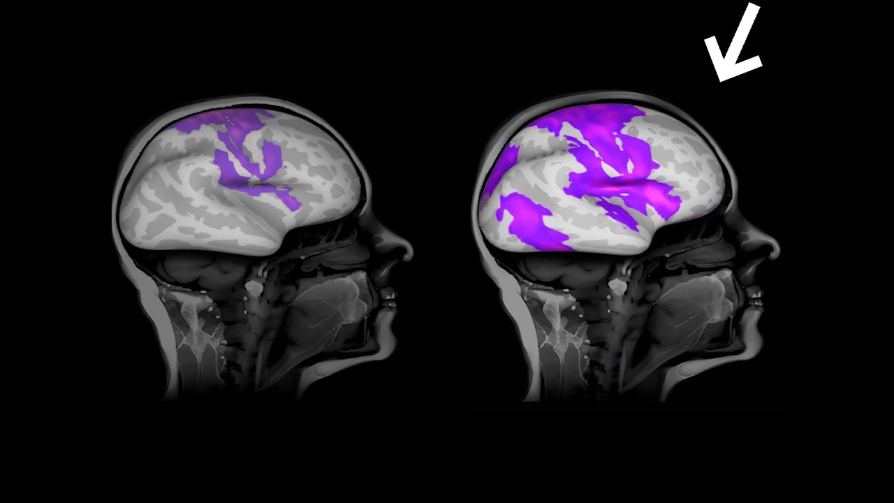 Normal Brain vs. Brain.fm Brain - Go IT