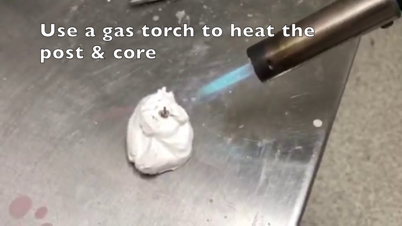 How to remove a Cast Post & Core from a dental crown - YouTube