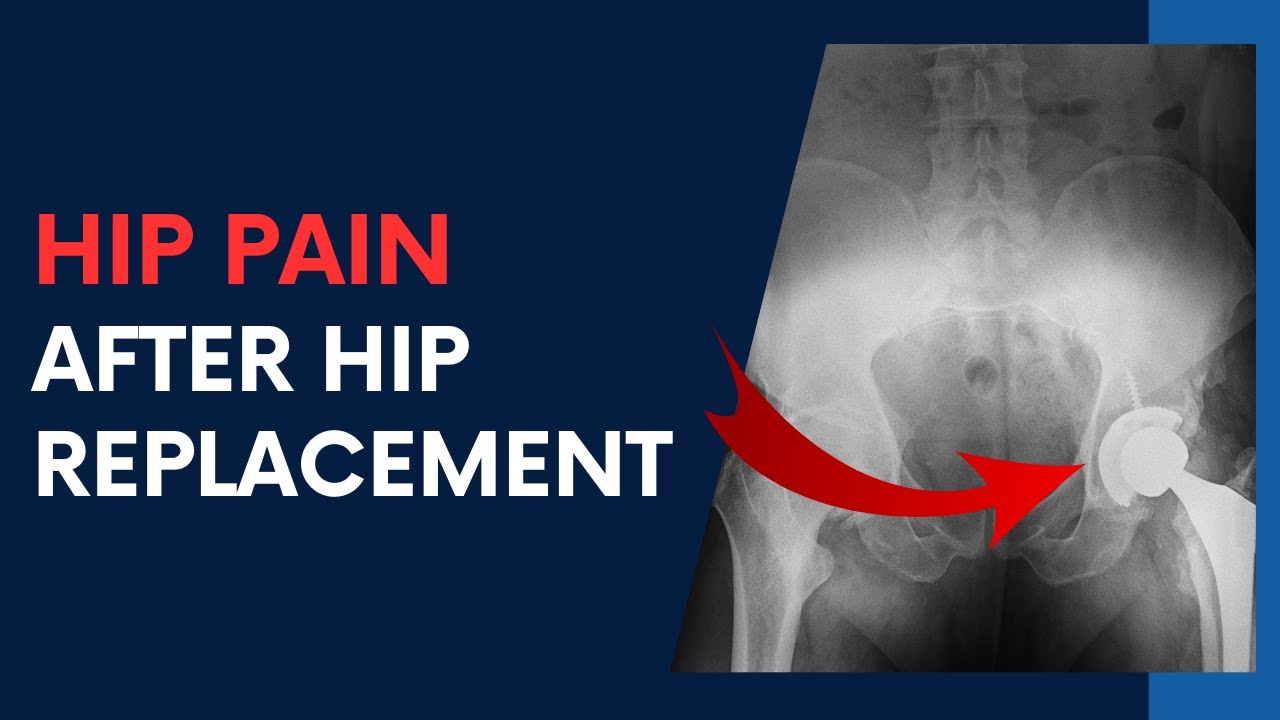 HIP PAIN after Hip Replacement Surgery - YouTube