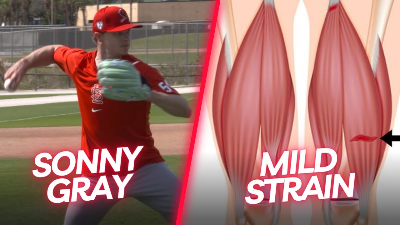 Sonny Gray Has Mild Hamstring Strain - YouTube