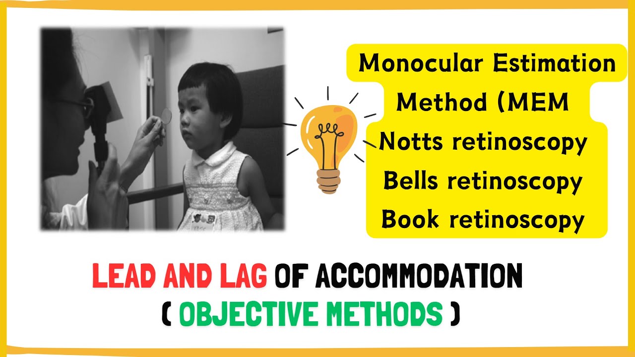 Lead and Lag Made Simple: MEM, Notts, Bell, and Book Retinoscopy ...