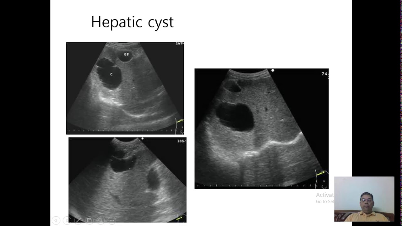 Imaging of HPB - YouTube