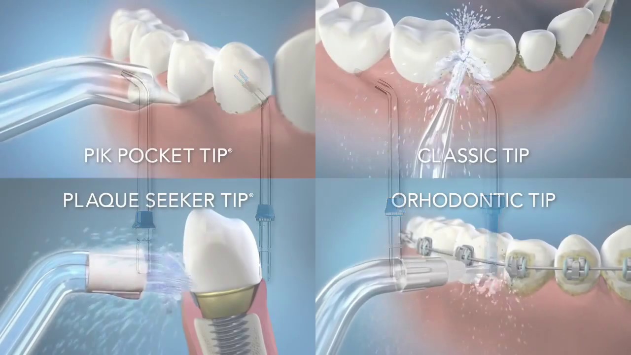How to Use the Waterpik® Complete Care 5 0 and 5 5 Water Flosser ...