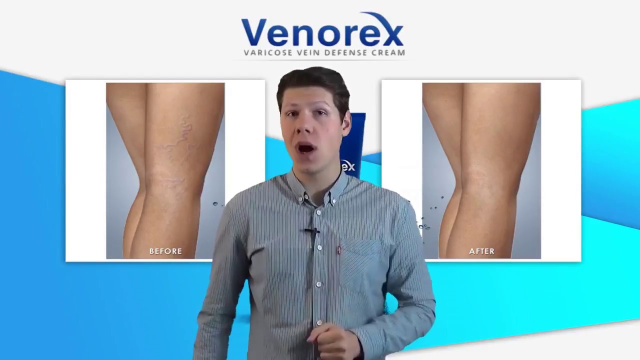 Venorex Cream Walmart - Venorex Cream Ingredients - YouTube
