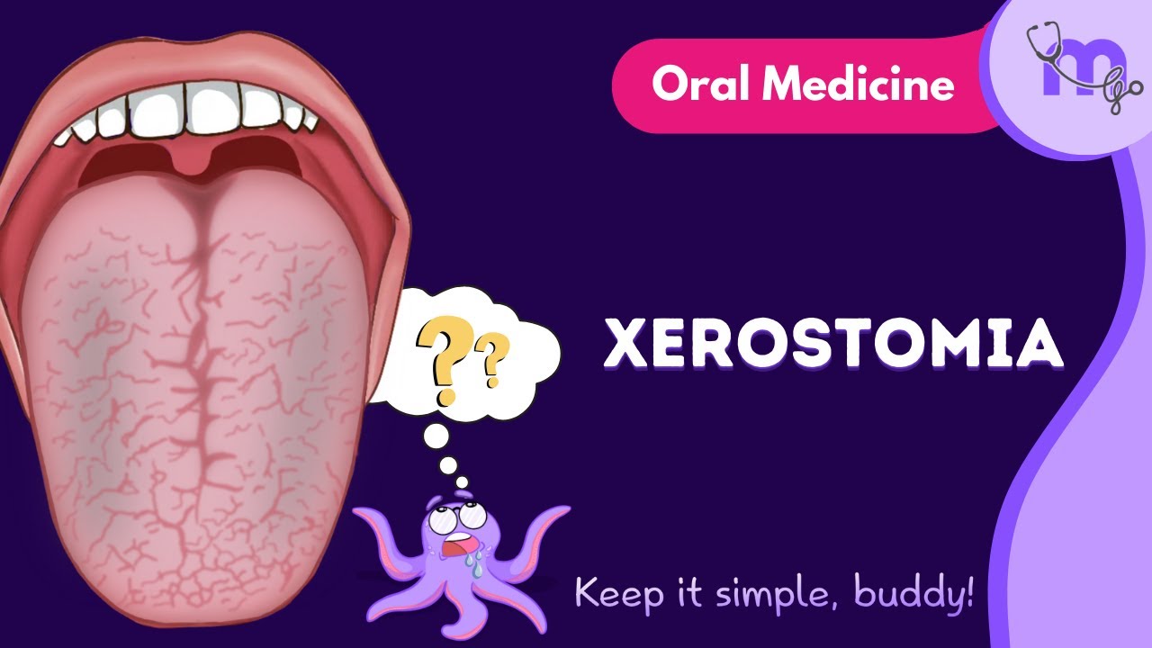 Xerostomia | Full Video | Oral Medicine | Medi Study Go - YouTube